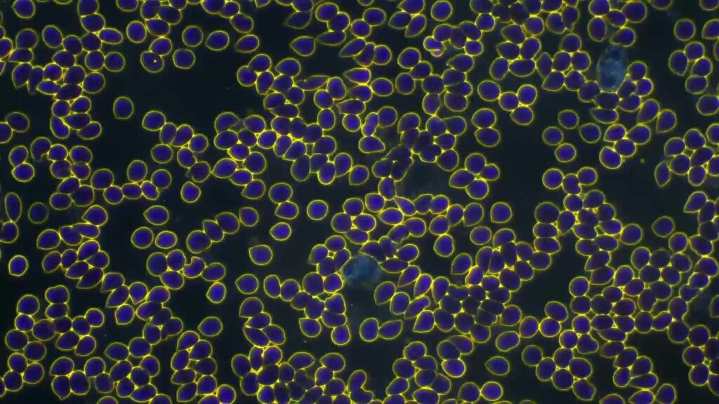 Live Blood Analysis in Houston, Texas