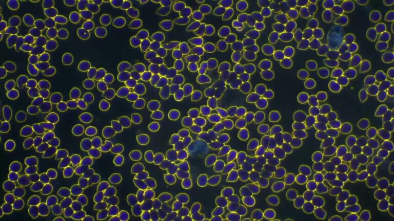 Live Blood Analysis in Houston, Texas