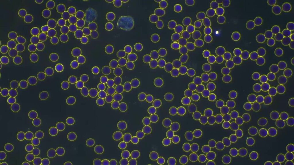 Live Blood Analysis in Houston, Texas