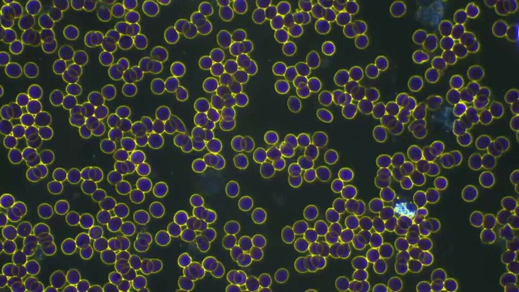 Live Blood Analysis in Houston, Texas